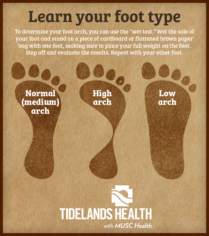 Do you have 'normal' foot arches? How to find out
