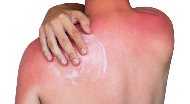 The nightmare known as hell's itch