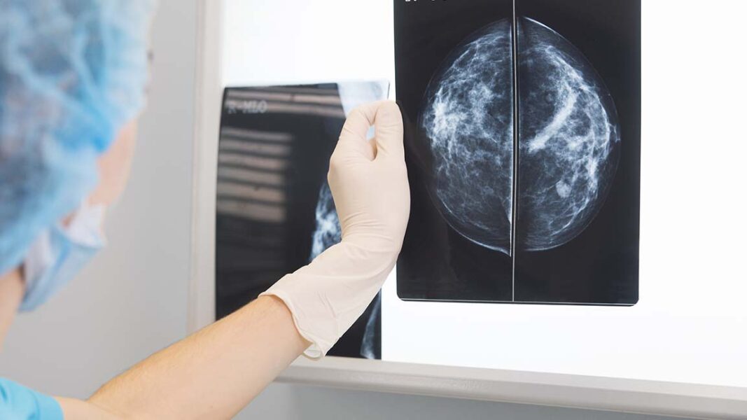 Top 10 tips to prepare for your mammogram